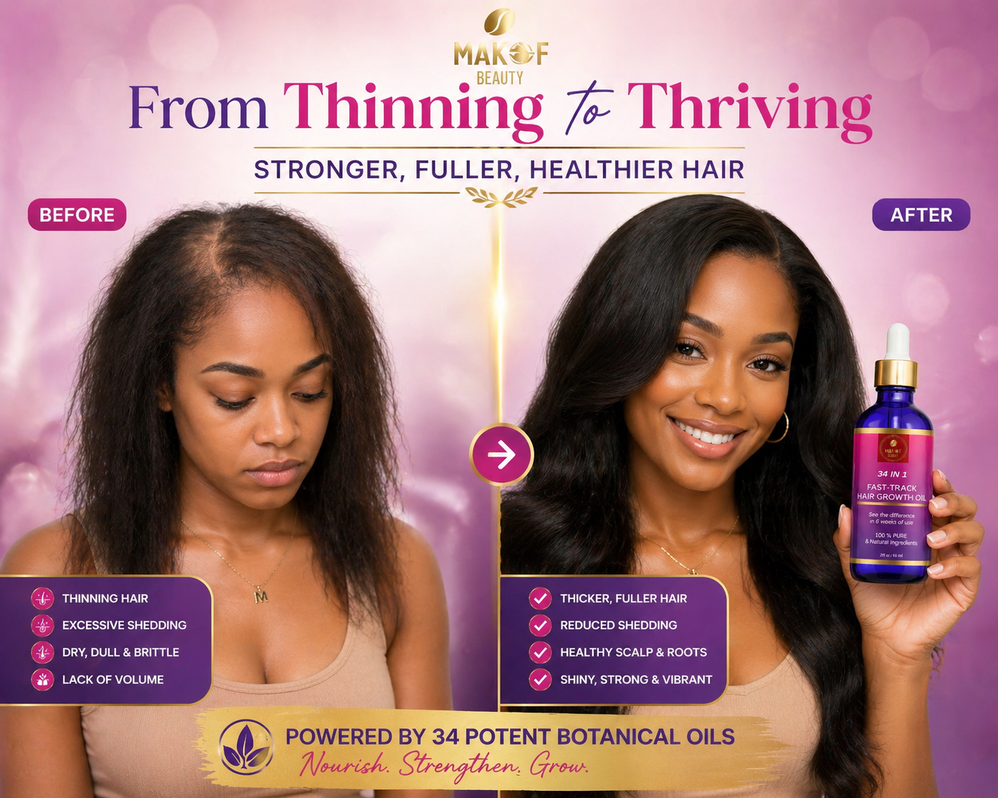 Hair Growth Mixture, Fast Track Hair Oil (34 in 1) for rapid growth, M ...